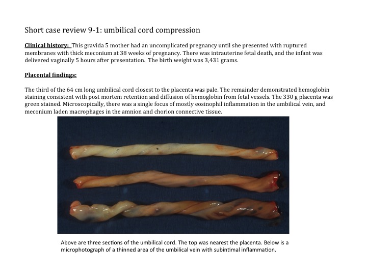 Chapter 2 supplement: Short case report #1: Umbilical cord compression ...