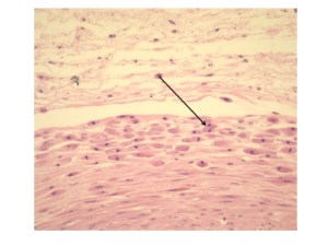 Chapter 6 Meconium | obstetrical pathology