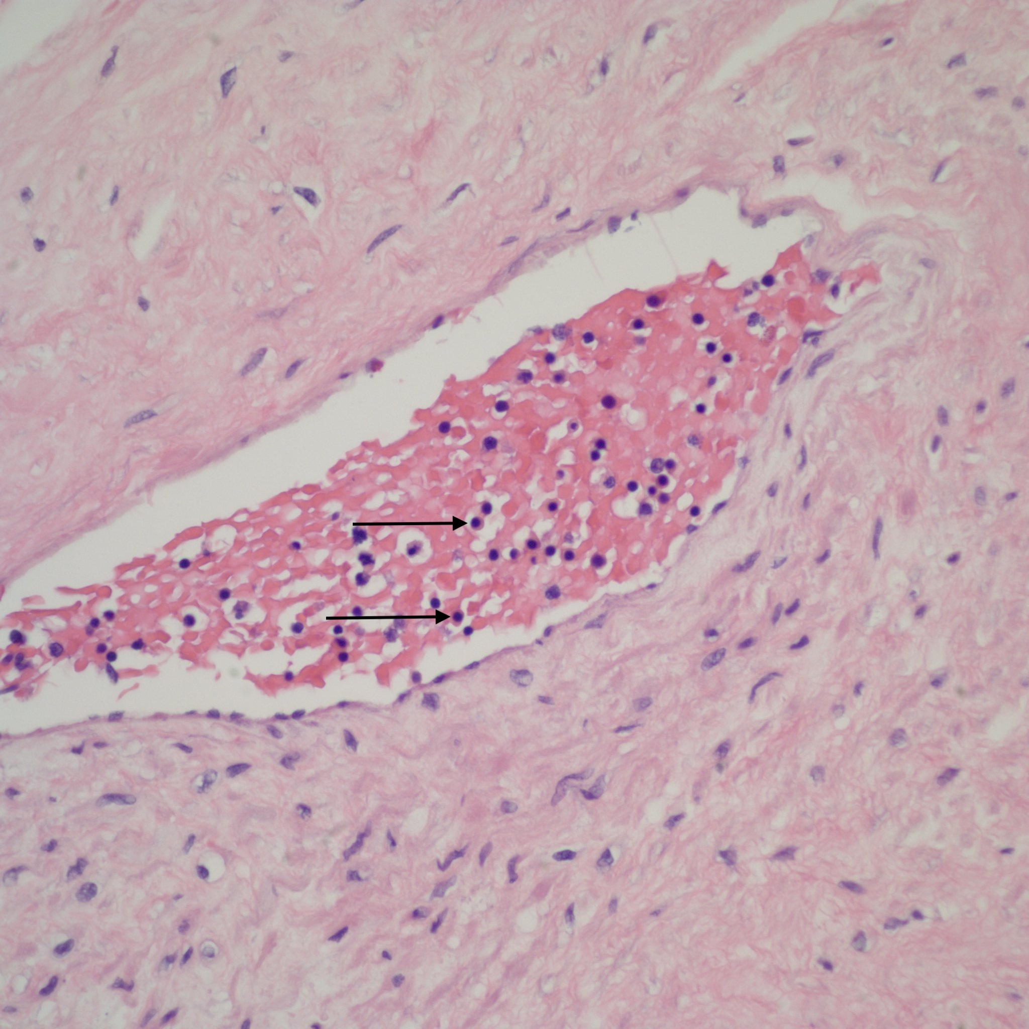 Chapter 7: Fetal blood cells | obstetrical pathology