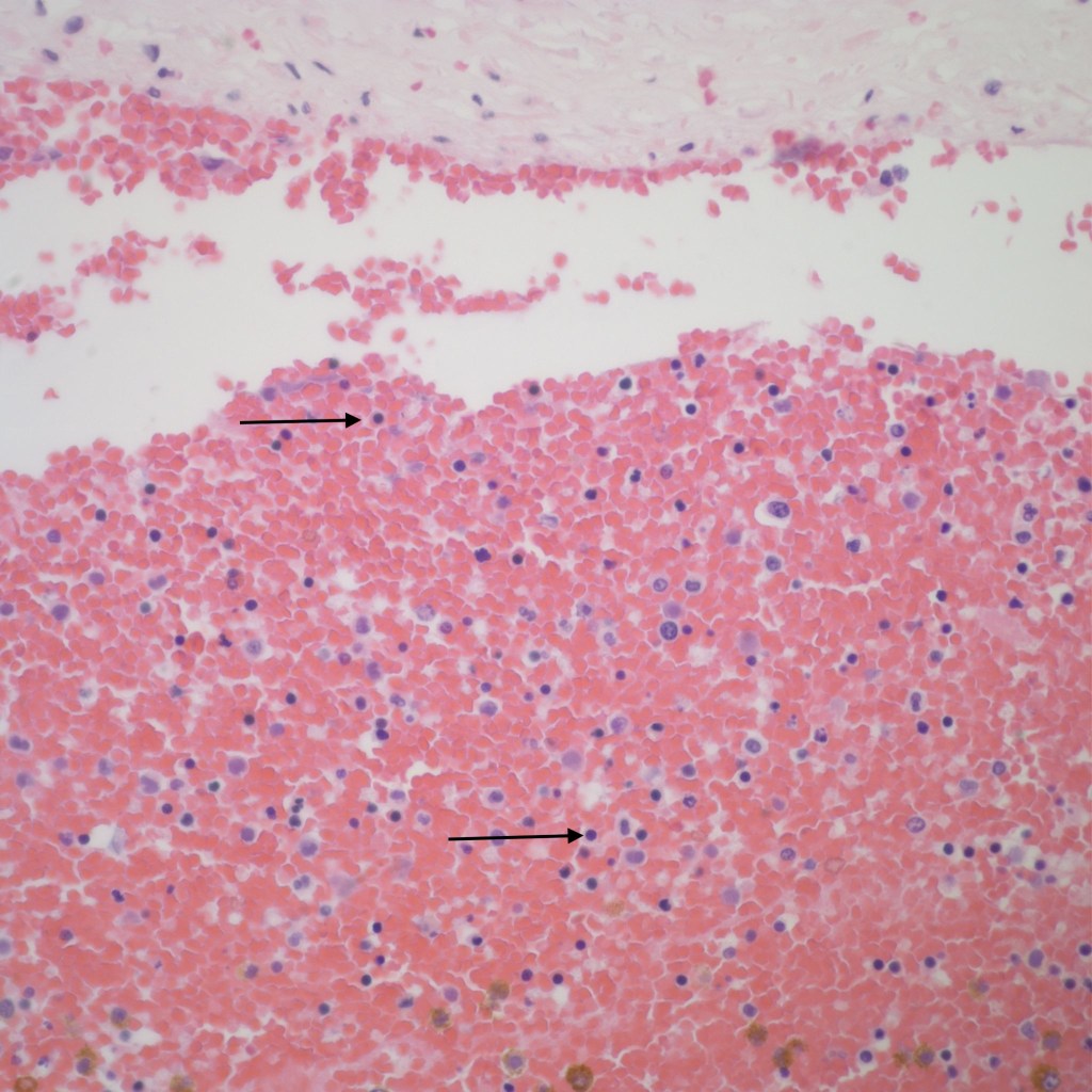 Chapter 7: Fetal blood cells | obstetrical pathology