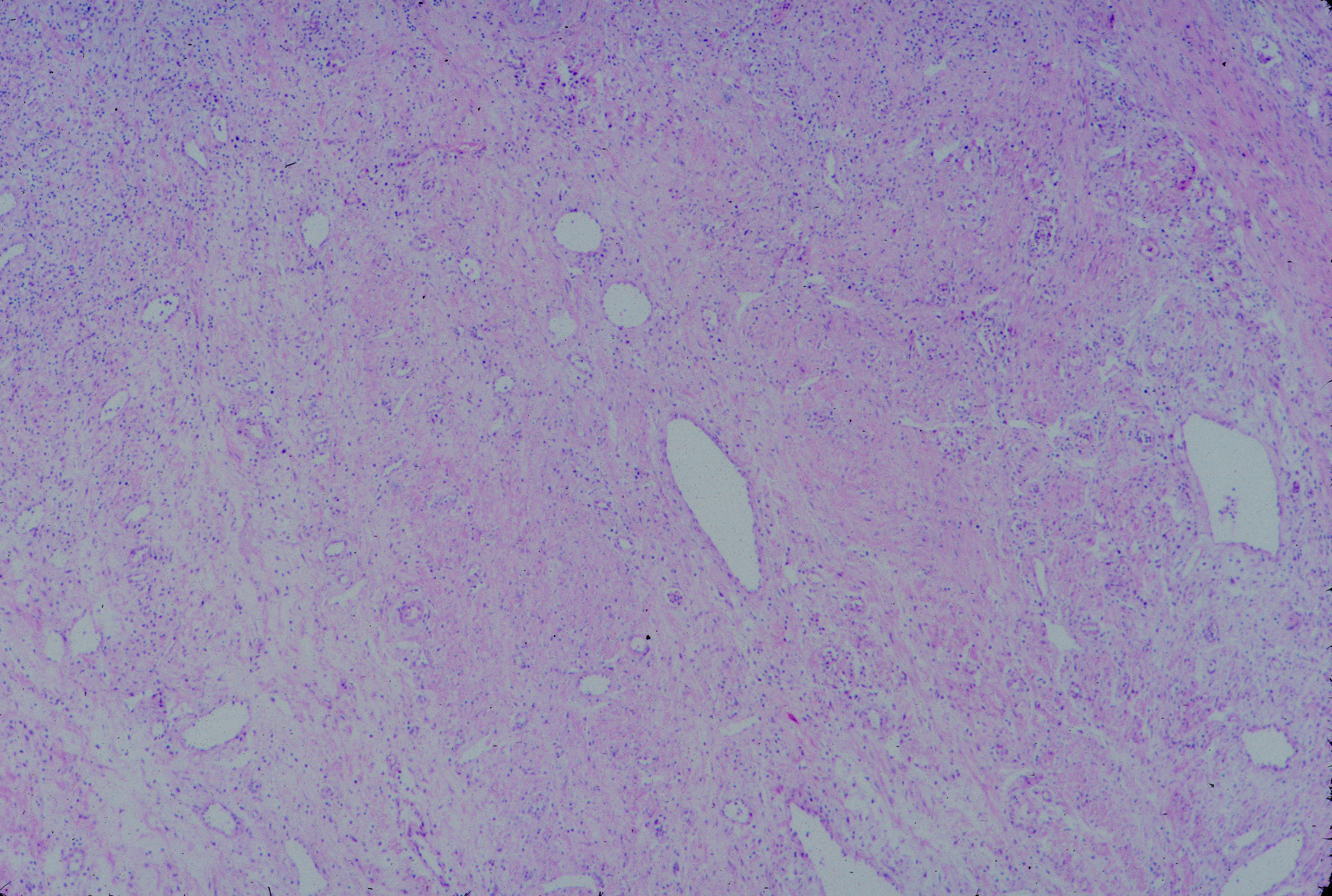 Chapter 13 Preterm Labor: Section A The Cervix | obstetrical pathology
