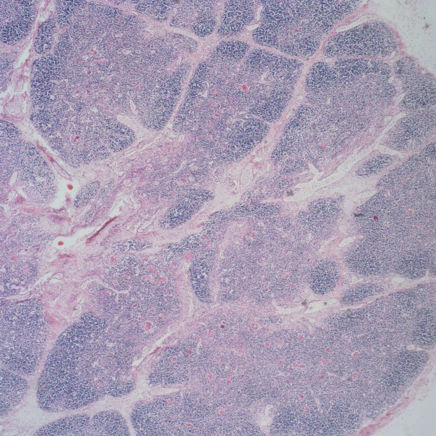 Autopsy Manual: Thymus | obstetrical pathology