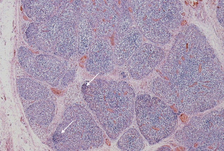 Autopsy Manual: Thymus | obstetrical pathology