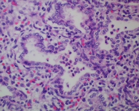 Autopsy Manual: Lung | obstetrical pathology