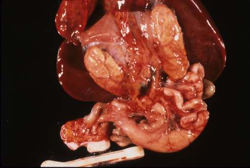 Fetal Autopsy: Kidney | The Autopsy Book