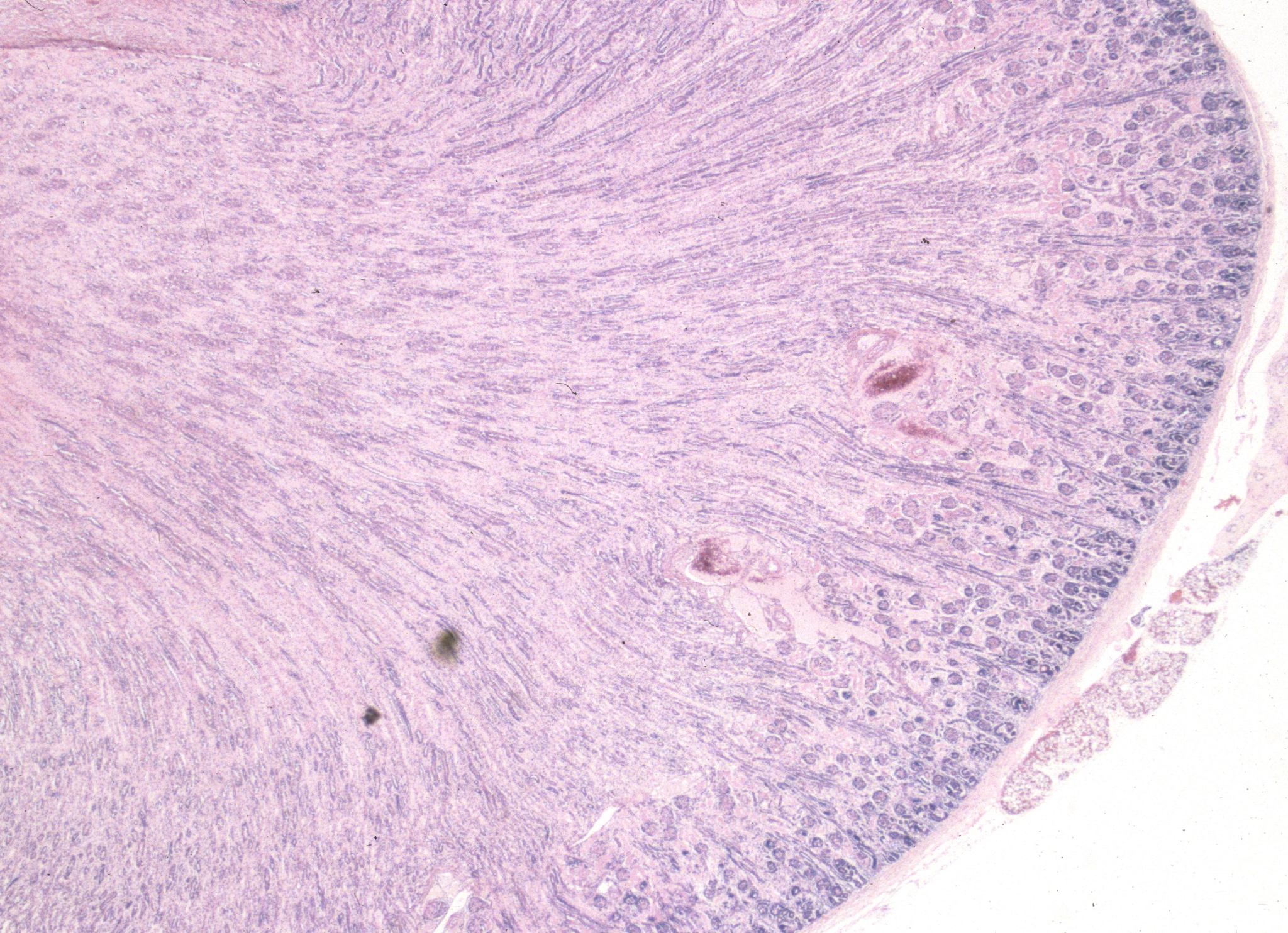 Kidney: Autopsy Manual | obstetrical pathology