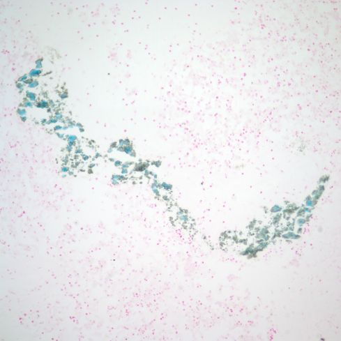 Autopsy Manual: Liver | obstetrical pathology