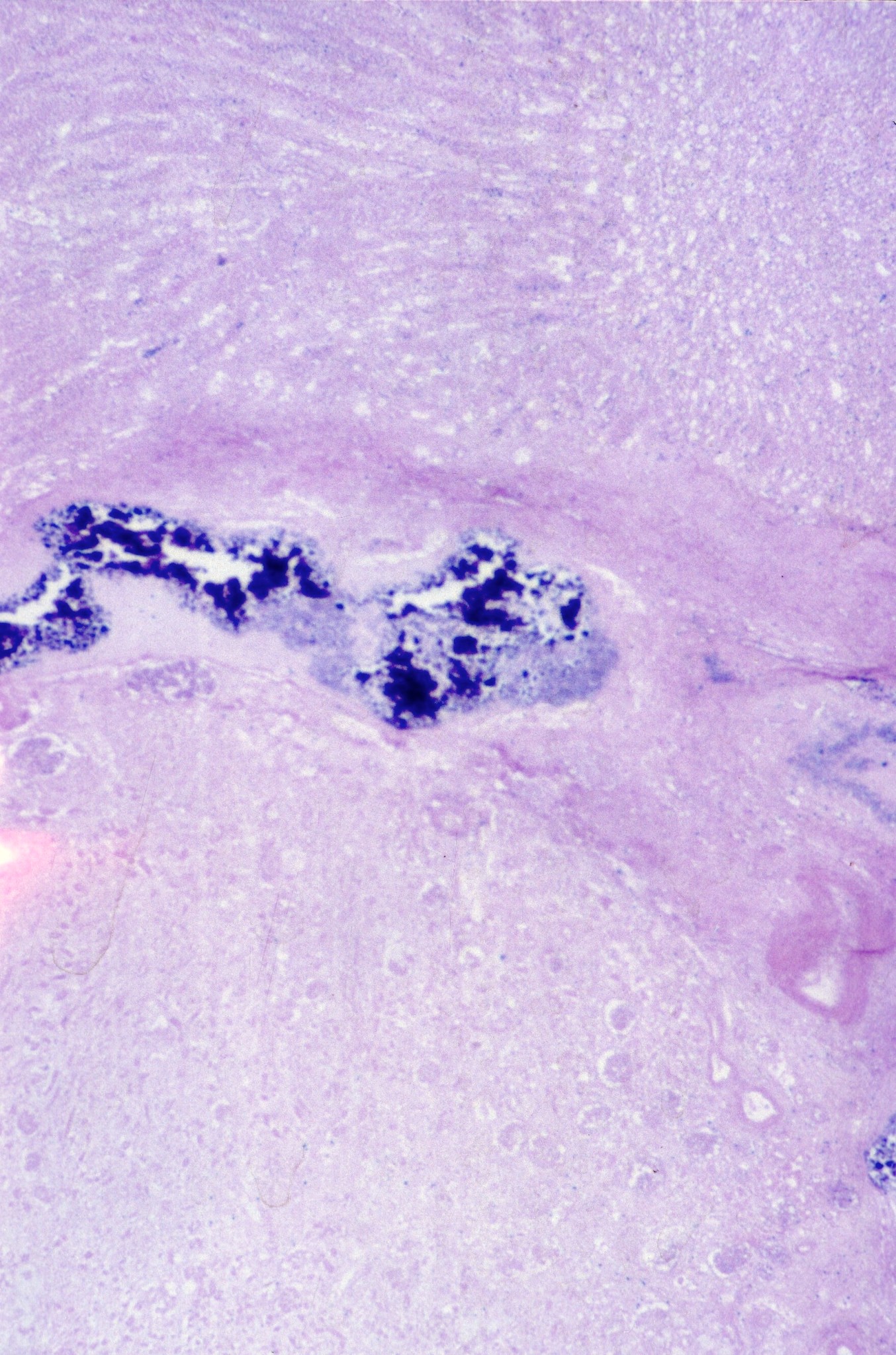 Kidney: Autopsy Manual | obstetrical pathology
