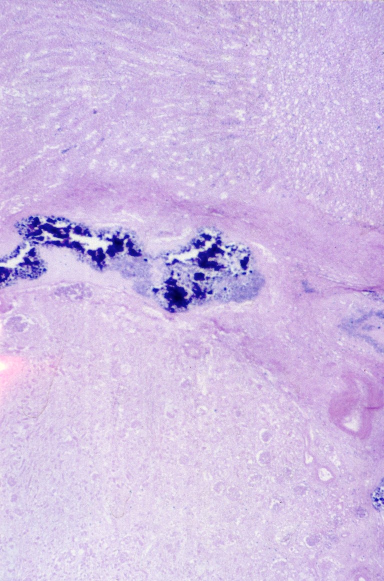 Kidney: Autopsy Manual | obstetrical pathology