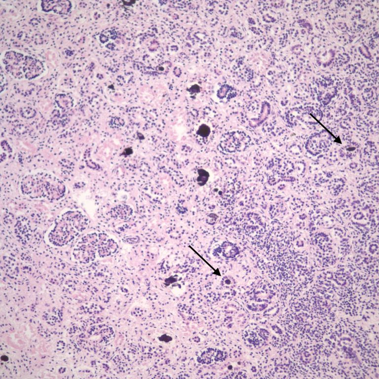 Kidney: Autopsy Manual | obstetrical pathology