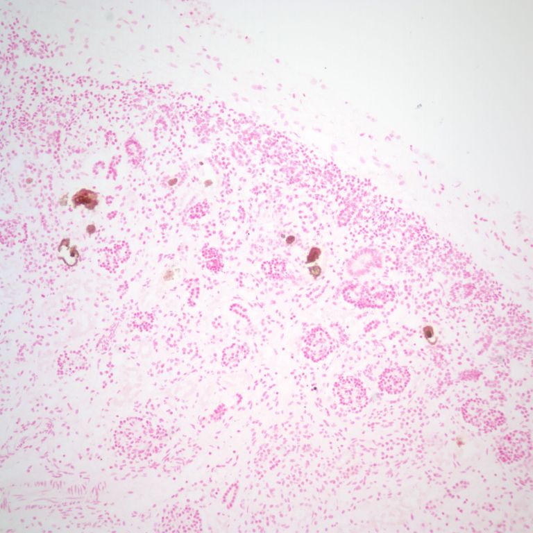 Kidney: Autopsy Manual | obstetrical pathology