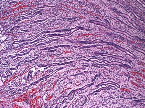 Kidney: Autopsy Manual | obstetrical pathology