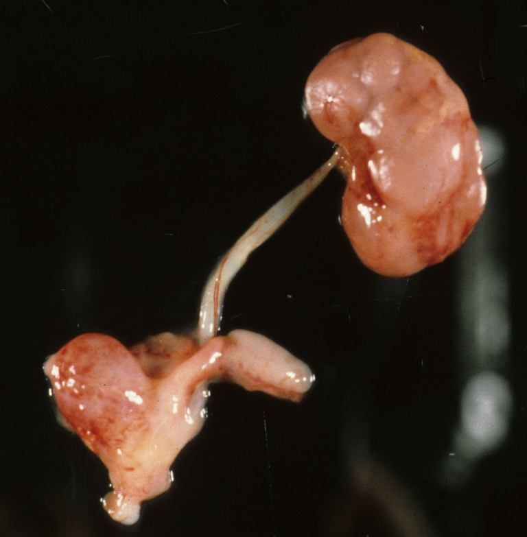 Kidney: Autopsy Manual | obstetrical pathology