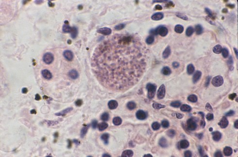 Kidney: Autopsy Manual | obstetrical pathology