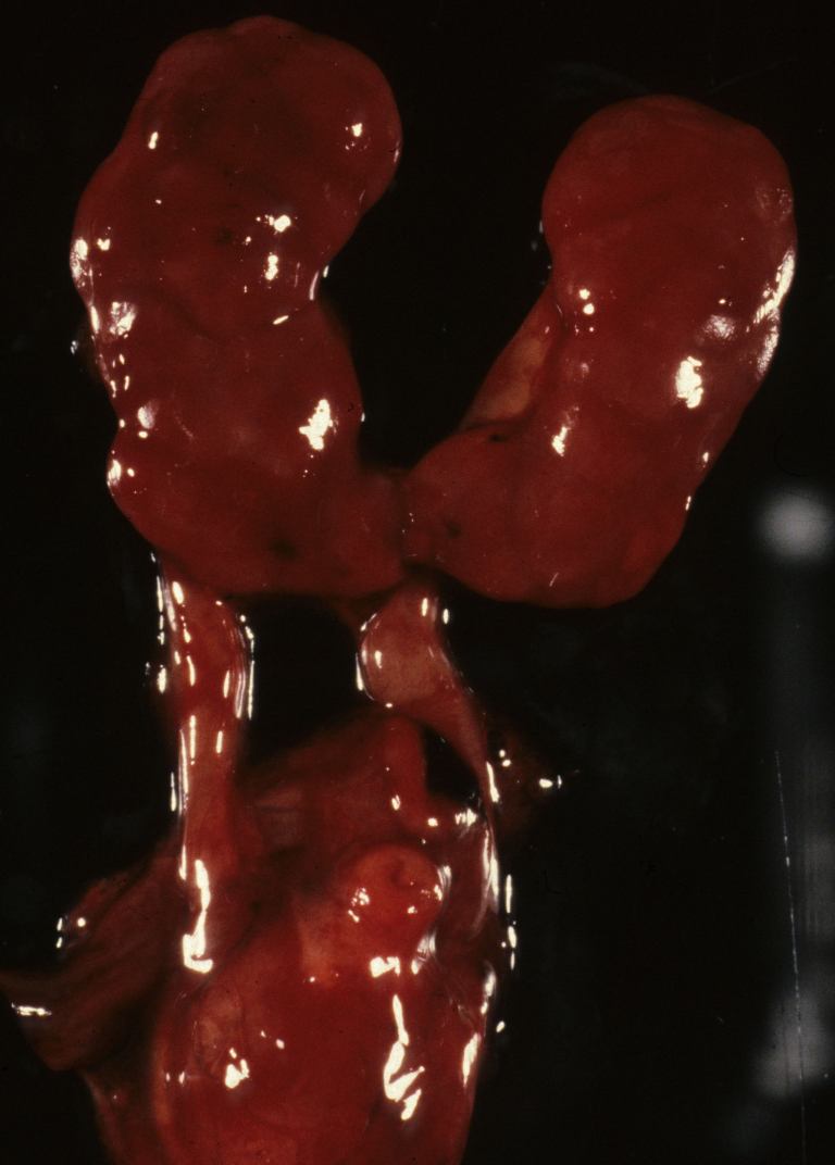 Fetal Autopsy: Kidney | The Autopsy Book