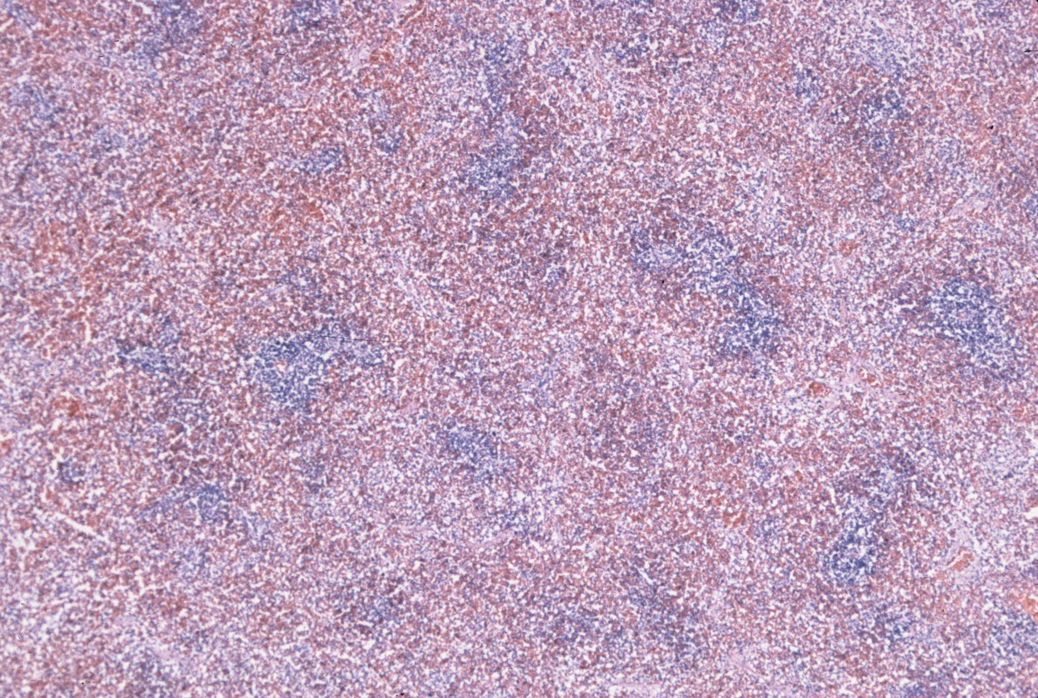 Autopsy Manual: Spleen | obstetrical pathology