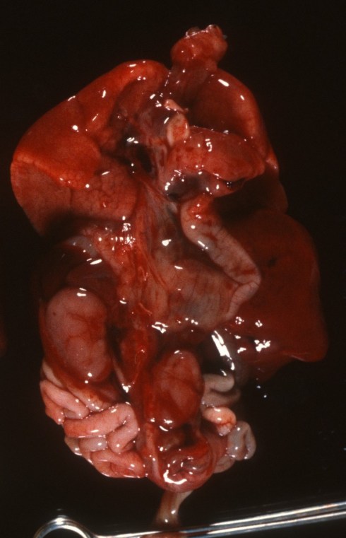 Kidney: Autopsy Manual | obstetrical pathology