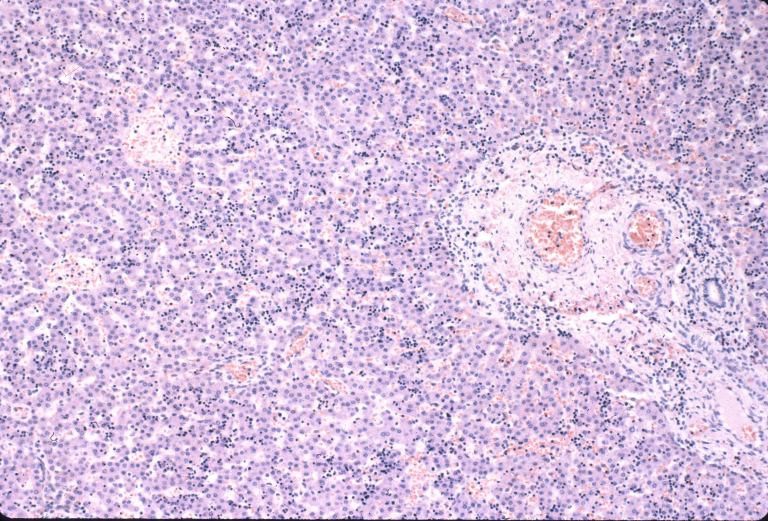 Autopsy Manual: Liver | obstetrical pathology