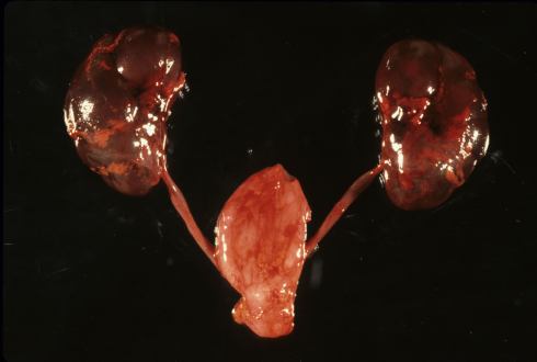 Kidney: Autopsy Manual | obstetrical pathology