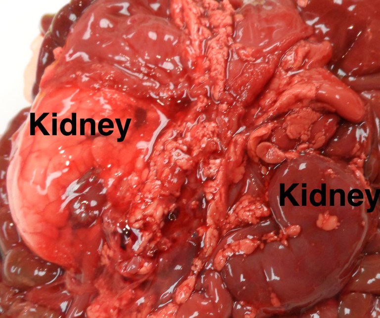 Fetal Autopsy: Kidney | The Autopsy Book