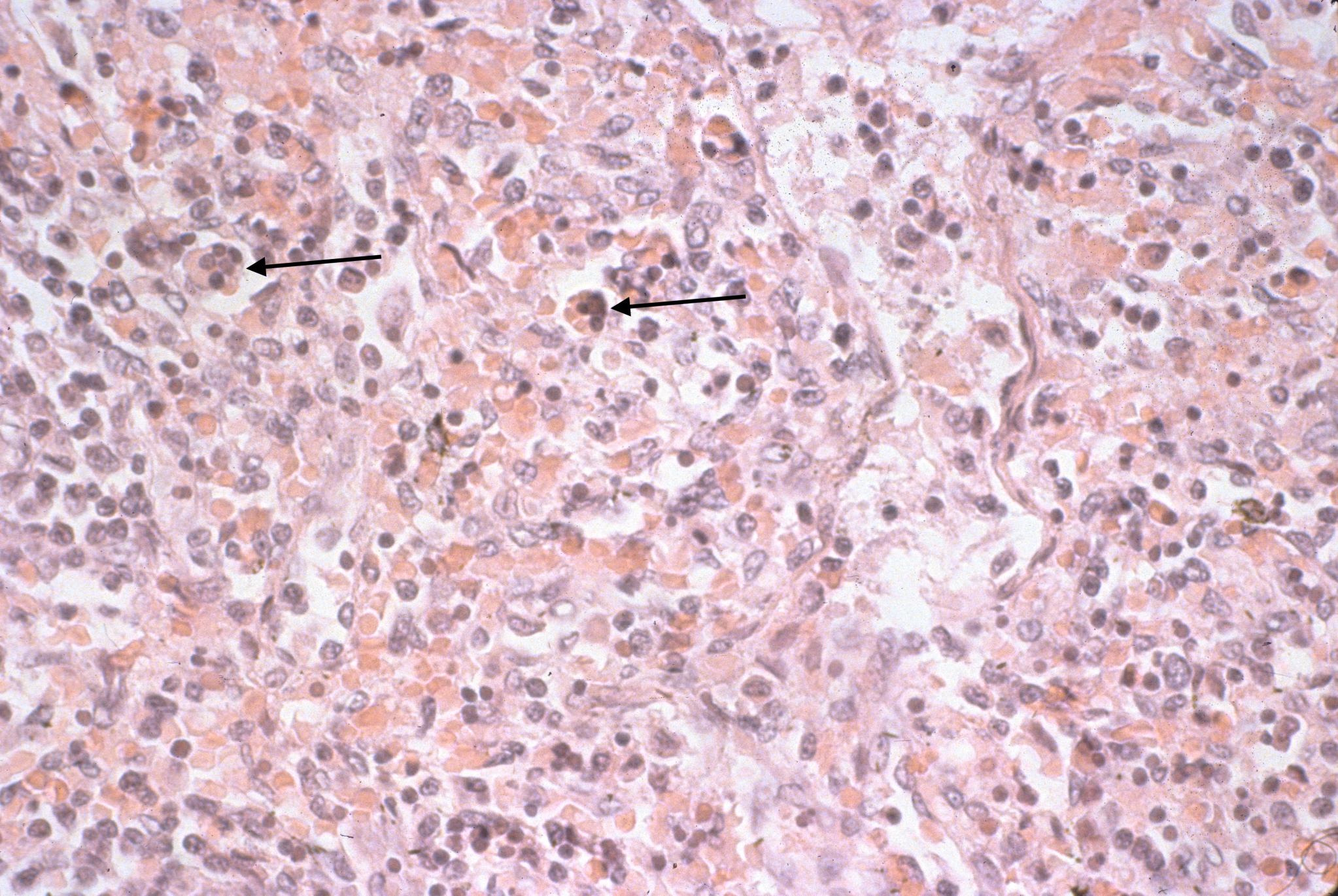 Autopsy Manual: Spleen | obstetrical pathology