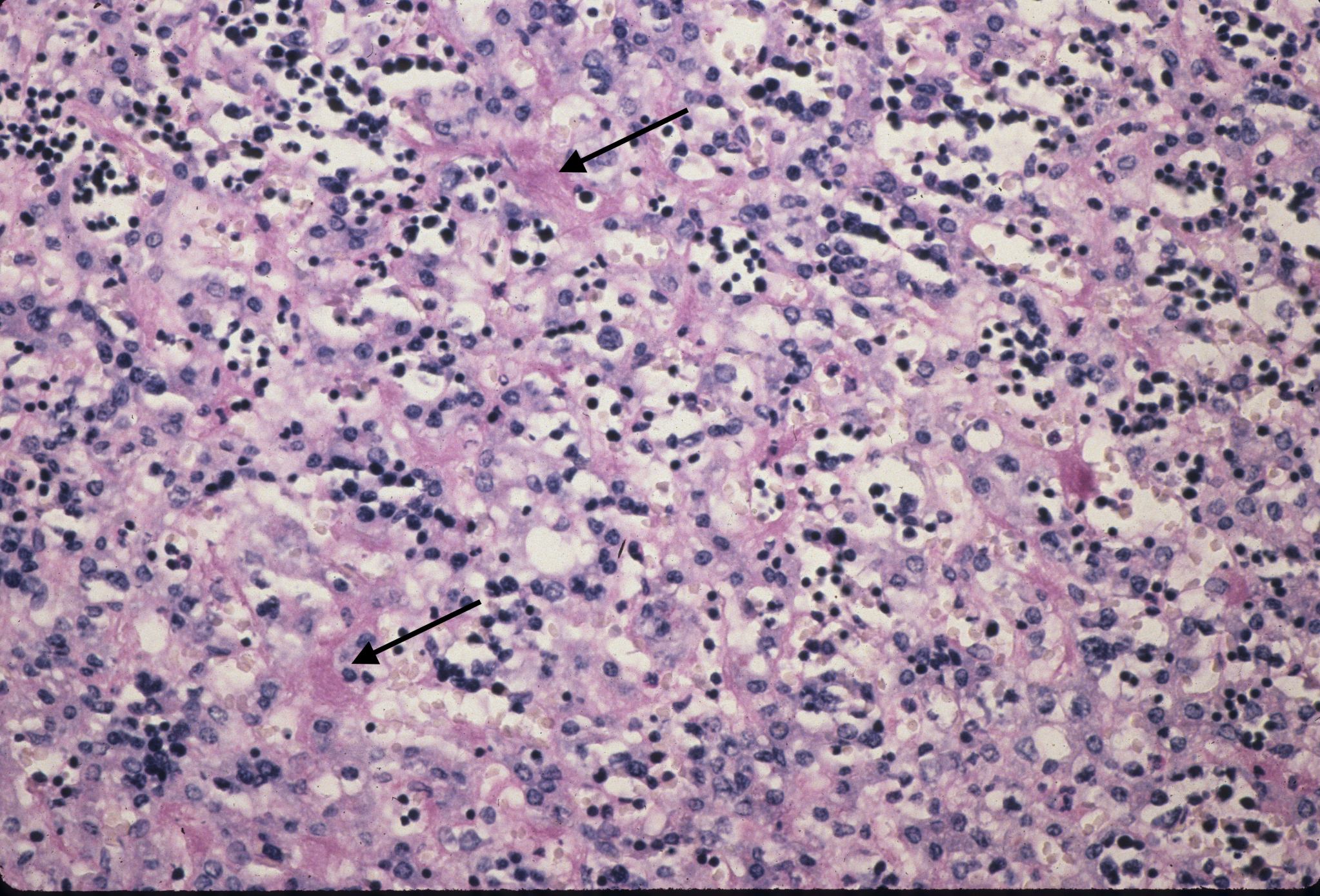 Autopsy Manual: Liver | obstetrical pathology